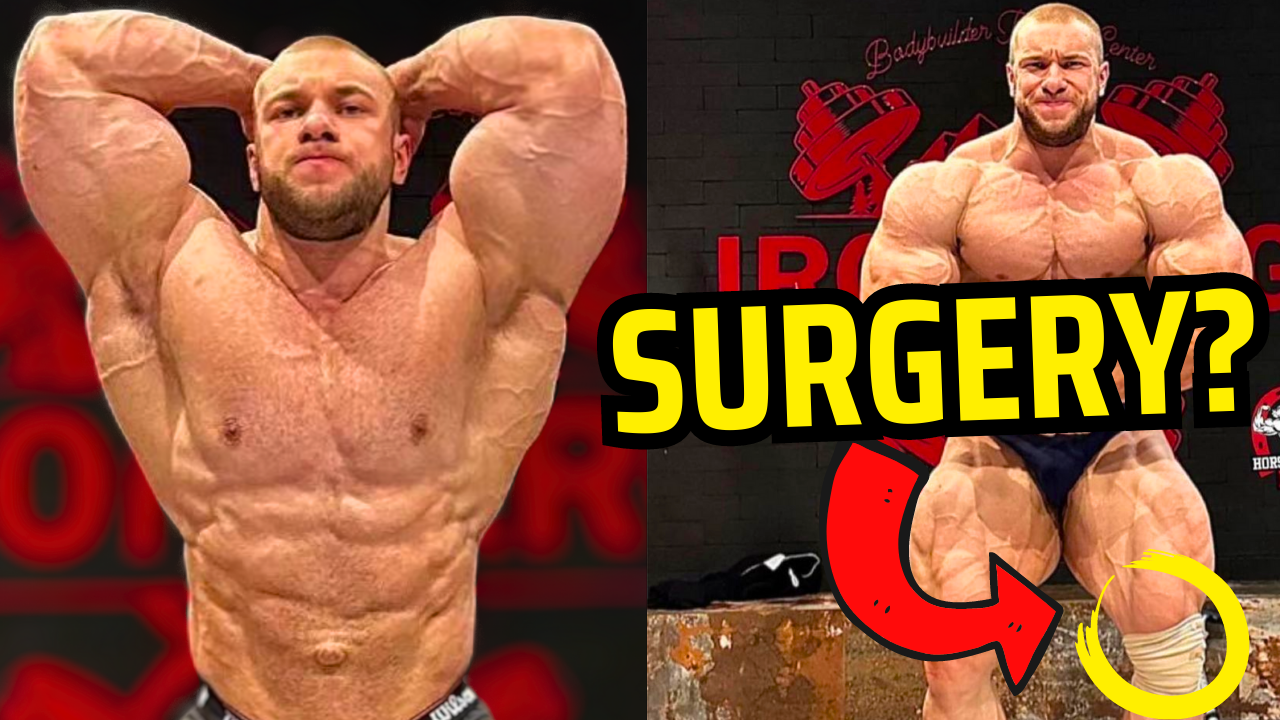 Nasser took 10 ANADROLS daily!